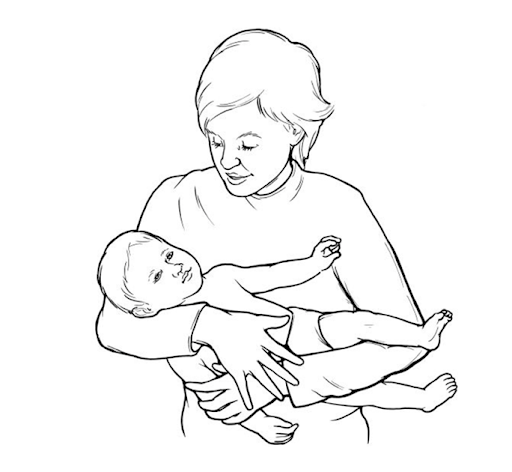 What Is Torticollis and How Is It Treated? - Milestone Pediatric Therapy